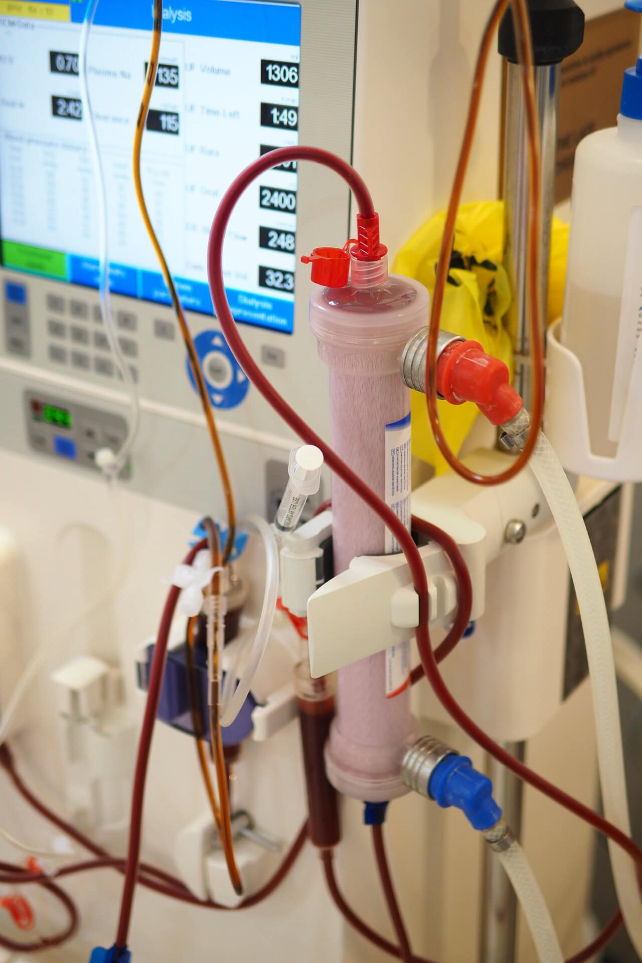 Baton of Life | The National Kidney Foundation (NKF) Singapore